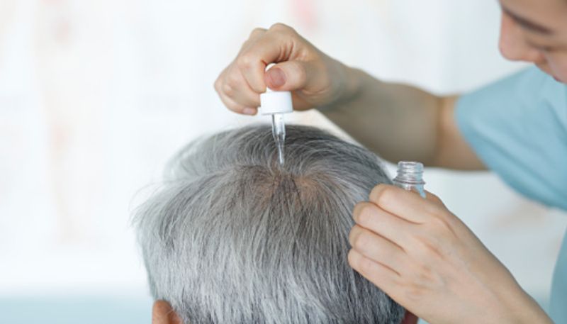 To solve white hair problem change to your daily diet - to solve white ...