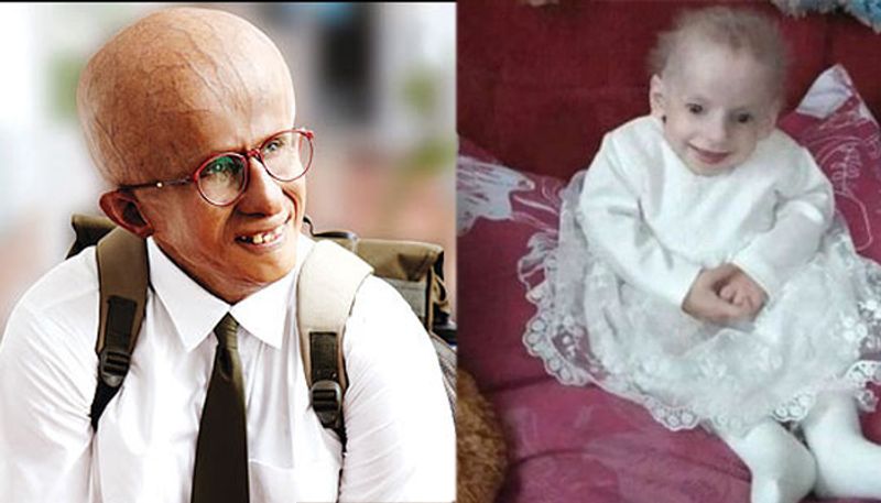 రియల్ లైఫ్‌లో ‘‘పా’’ : 8 ఏళ్లకే 80 ఏళ్ల బామ్మలా.. అరుదైన వ్యాధితో ...