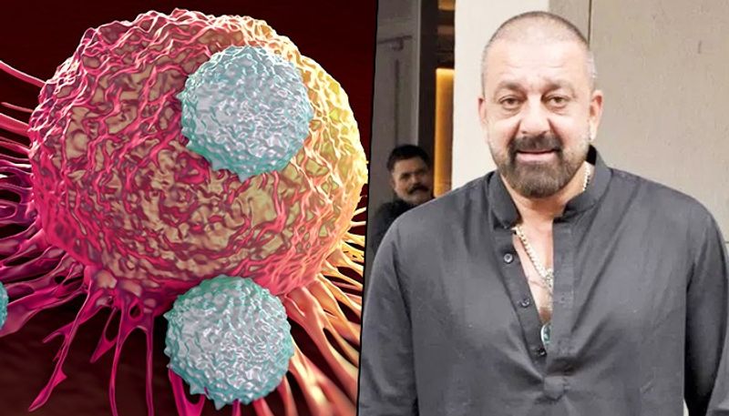 Sanjay Dutt diagnosed with cancer: 2 types of cancer that are difficult ...