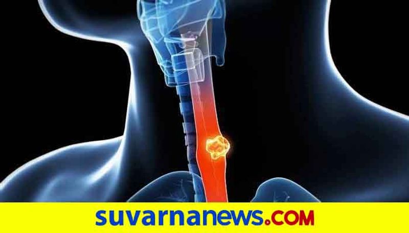 ಗಂಟಲಿನಲ್ಲಿ ಆಹಾರ ಸಿಲುಕಿಕೊಂಡಿದೆಯೇ? ತಕ್ಷಣ ಹೀಗೆ ಮಾಡಿ | What to do if food ...