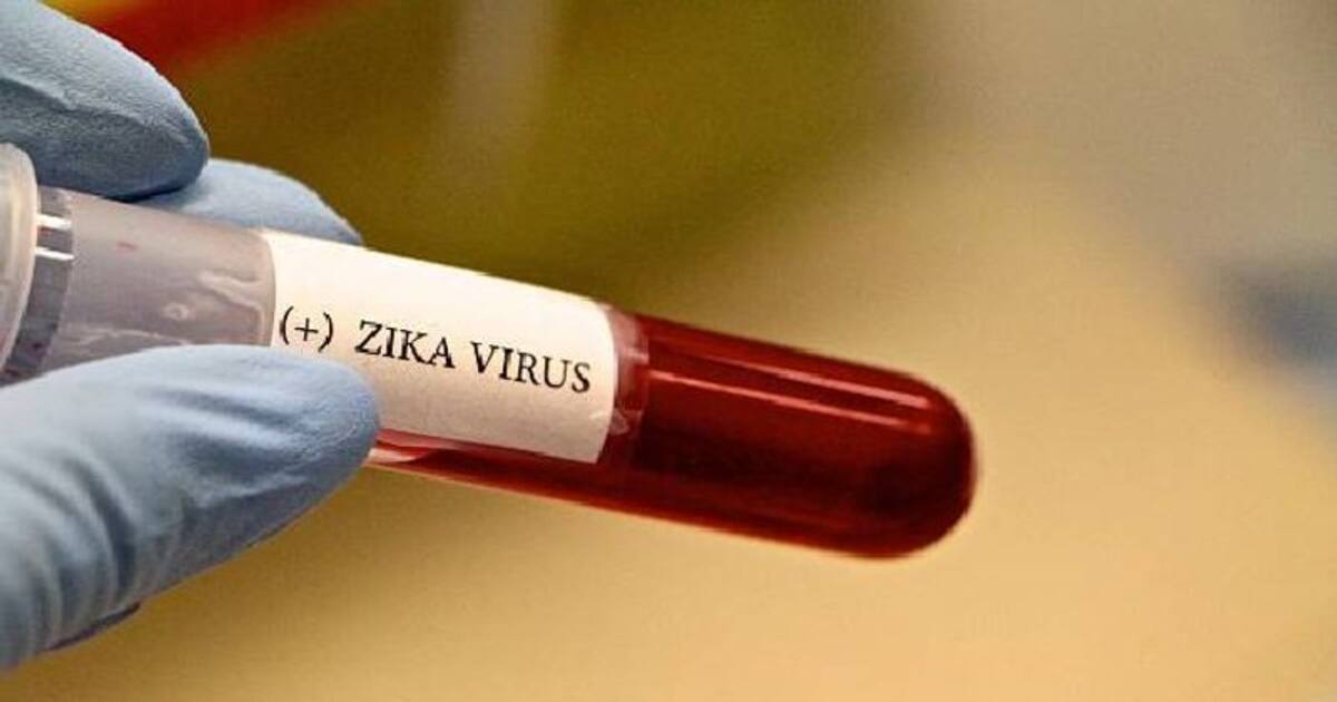 Zika Virus: Karnataka reports first case; know treatment, symptoms ... Zika Virus: Karnataka reports first case; know treatment, symptoms ...