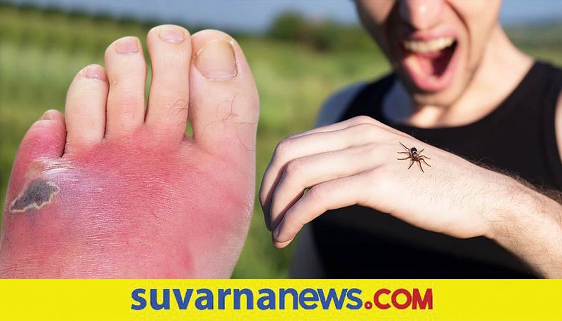 Spider bites : ರಾತ್ರಿ ಸರಿಯಿದ್ದ ಖಾಸಗಿ ಅಂಗ ಬೆಳಗಾಗೋದ್ರಲ್ಲಿ ದೊಡ್ಡದಾಗಿತ್ತು ...