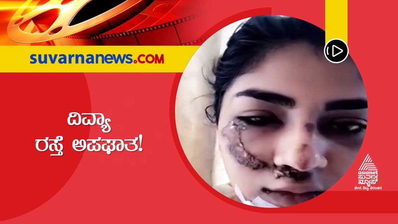 ನಾಯಿ ನಿಯಂತ್ರಿಸಲು ಹೋಗಿ ದ್ವಿಚಕ್ರ ವಾಹನದಿಂದ ಬಿದ್ದ ಬಿಗ್ ಬಾಸ್ Divya Suresh ...