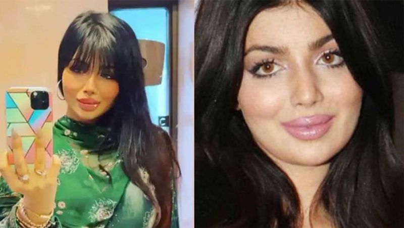 जब सर्जरी के बाद इतना बिगड़ गया था आयशा टाकिया का चेहरा, सूज गए थे होंठ ...