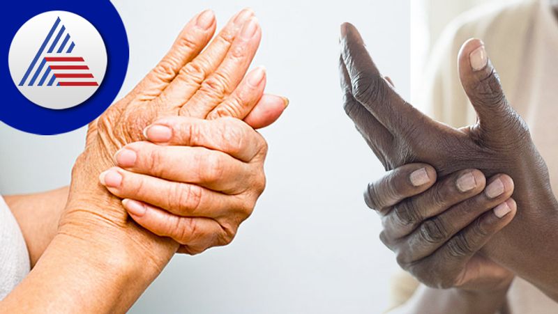 ಕೈ ನರಗಳಲ್ಲಿ ಊತ… ಇದಕ್ಕೆ ಕಾರಣವೇನಿರಬಹುದು? - What causes visible hand veins know the - Asianet News ...