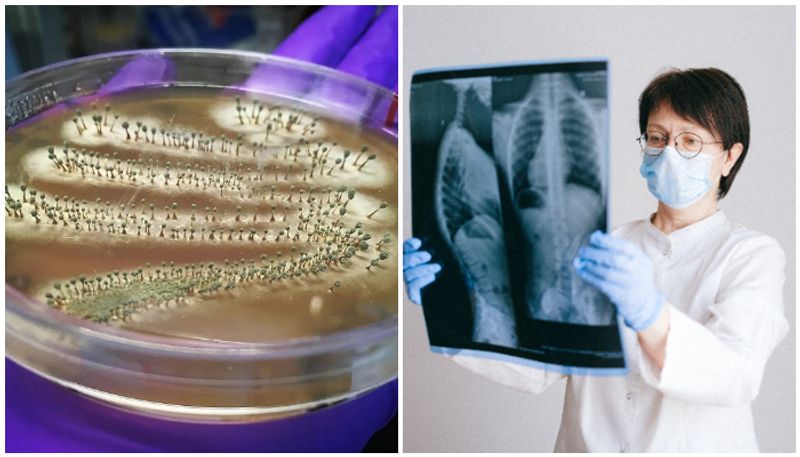Penicillin to X-rays: 7 groundbreaking discoveries in Medical Science ...
