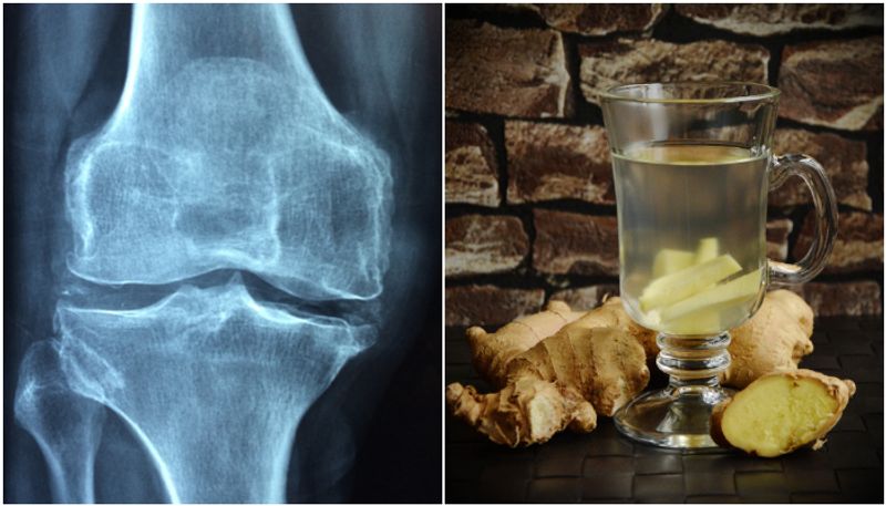 Discover 7 Natural Remedies for Joint Pain: Alleviate discomfort and ...