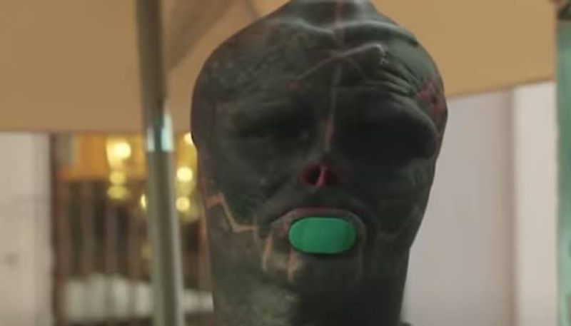 അന്യഗ്രഹജീവിയാകാൻ സ്വന്തം മൂക്കും ചെവിയും വിരലുകളും മുറിച്ച് 35 -കാര ...