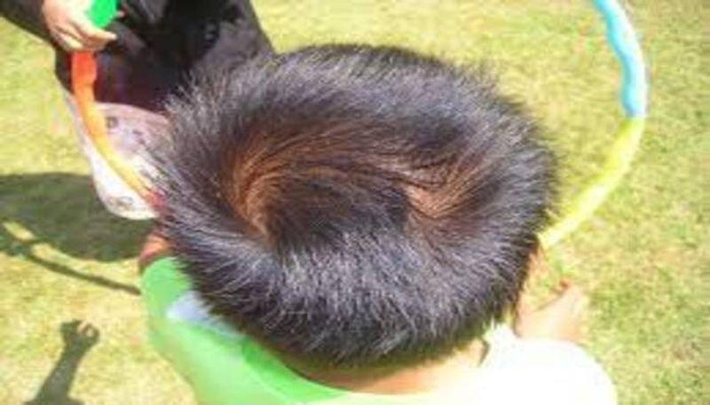 myths and scientific reasons behind double whorl in head
