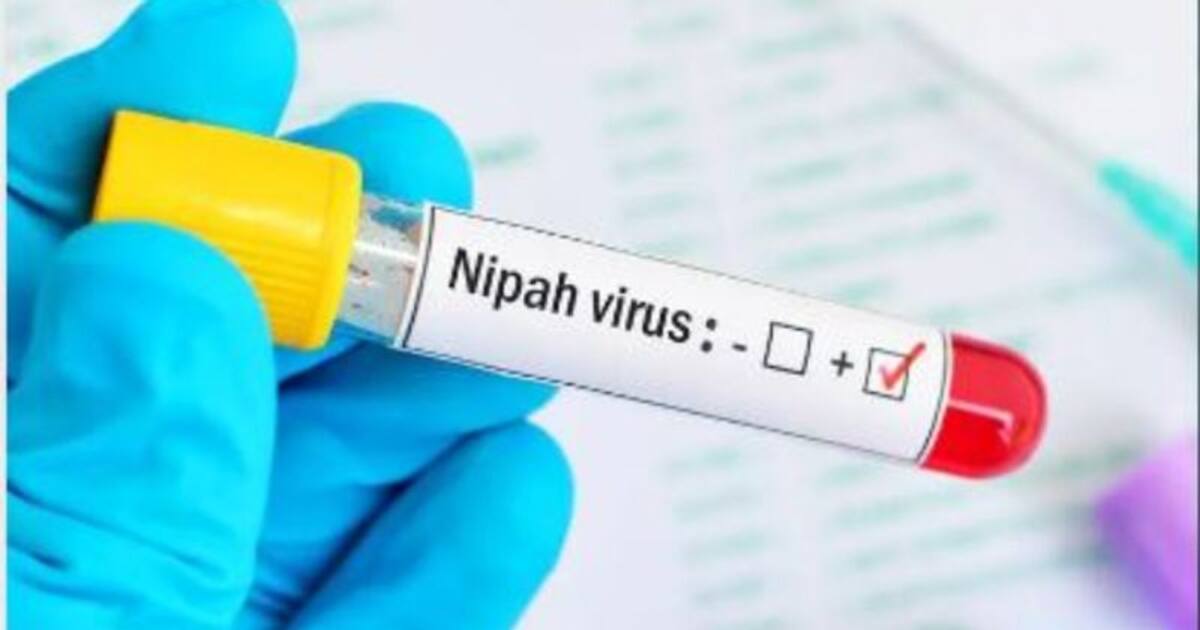 nipah case malappuram നിപ വന്നത് കൂട്ടുകാര്ക്കൊപ്പം ടൂറ് പോയപ്പോള് ... nipah case malappuram നിപ വന്നത് കൂട്ടുകാര്ക്കൊപ്പം ടൂറ് പോയപ്പോള് ...