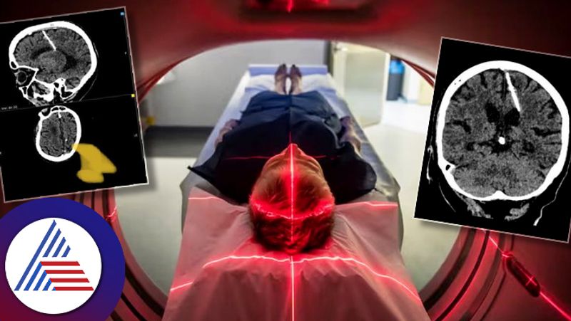 Weird News: ಮೆದುಳಲ್ಲಿ ಸೂಜಿ ಇಟ್ಕೊಂಡೇ 80 ವರ್ಷ ಬದುಕಿದ್ದಾಳಂತೆ ಈ ಮಹಿಳೆ ...