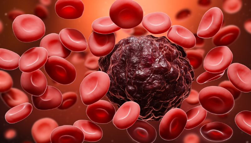 World Cancer Day 2024: Know the truths and myths of Blood Cancer ...