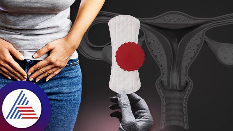 Periods ರಕ್ತಸ್ರಾವದ ಹೊರತು ಪದೇ ಪದೇ ಸ್ಪಾಟಿಂಗ್ ಆಗೋದಿಕ್ಕೆ ಕಾರಣವೇನು? - What ...