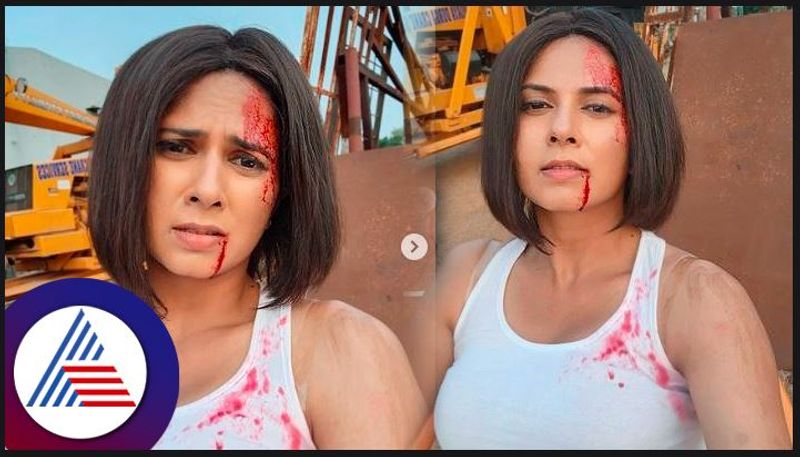 JCB 'ಗಾಳಿಪಟ' ನಟಿ Daisy Bopanna ಹಣೆಗೆ ಗಾಯ; Blood ನೋಡಿ ನೆಟ್ಟಿಗರು ಗಾಬರಿ ...