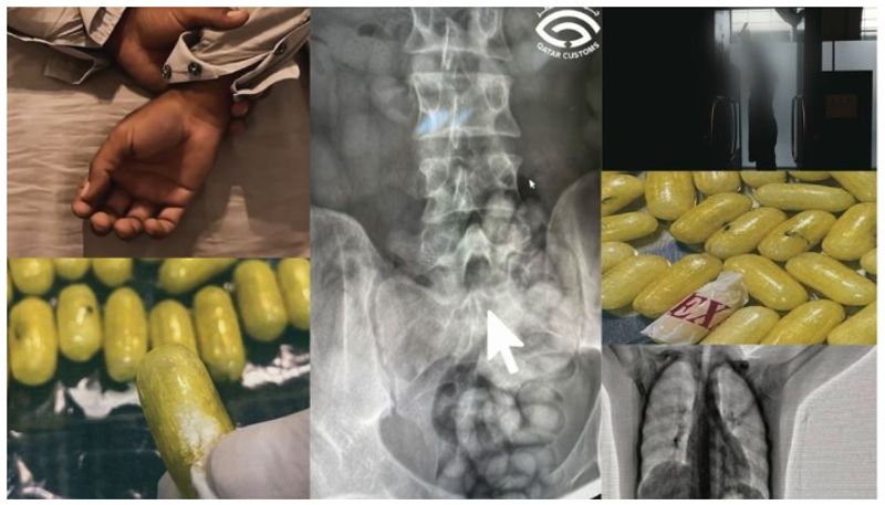 Drugs concealed inside body: ഉദ്യോഗസ്ഥന് സംശയം, ബോഡി സ്കാനര്‍ പരിശോധന ...