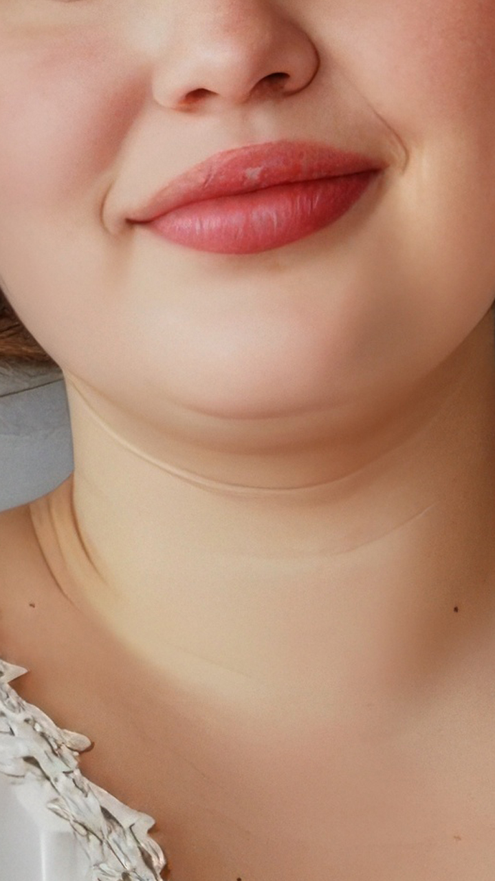 Essential Lip care tips for healthy, beautiful lips | Asianet Newsable