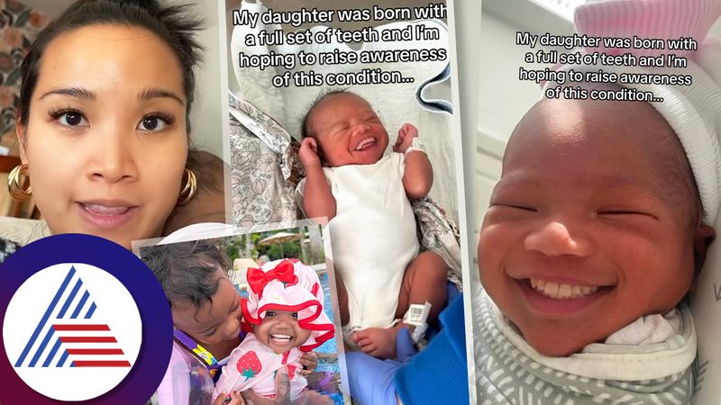 Baby girl born with 32 teeth ವಿಡಿಯೋ ಹಂಚಿಕೊಂಡ ತಾಯಿ - Girl baby born with ...