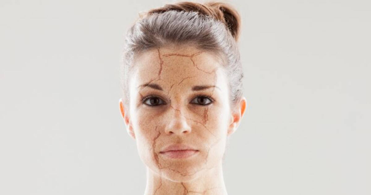 tips to get rid dry skin ചര്മ്മം വരണ്ട് പ്രായക്കൂടുതല് ... tips to get rid dry skin ചര്മ്മം വരണ്ട് പ്രായക്കൂടുതല് ...