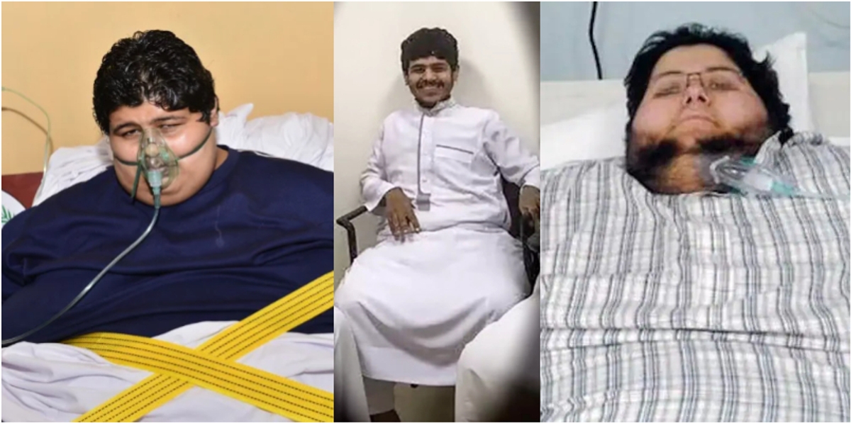 ಅಬ್ಬಬ್ಬಾ! ಬರೋಬ್ಬರಿ 610 ಕೆಜಿಯಿಂದ 63 ಕೆಜಿಗೆ ದೇಹತೂಕ ಇಳಿಸಿಕೊಂಡ ವಿಶ್ವದ ಅತ್ಯಂತ ತೂಕದ ವ್ಯಕ್ತಿ! ಹೇಗೆ ...