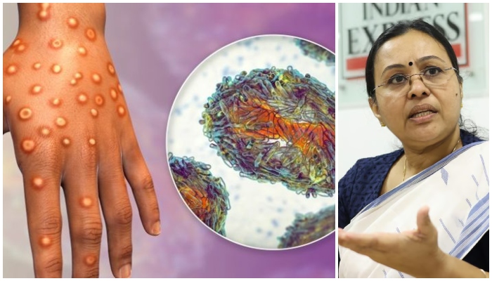 m pox disease confirmed in malappram kerala alert for expats കേരളത്തി ...