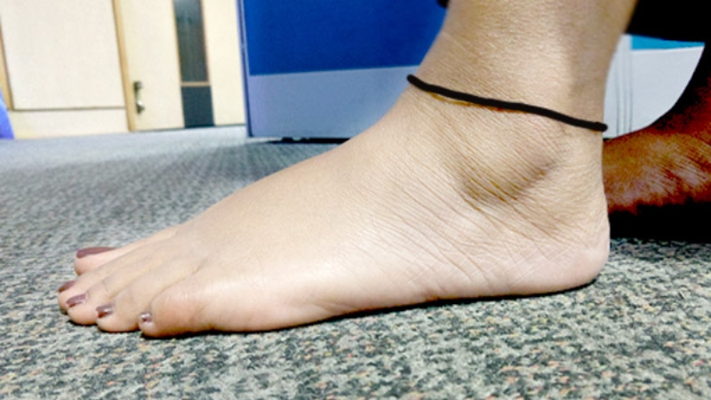 Benefits of Tying Black Thread on Legs for Women | Asianet Newsable