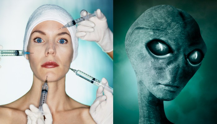 ATTENTION Ladies ! Avoid fillers in this facial area or risk 'alien ...