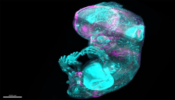 REMARKABLE! Human Cell Atlas maps all 37 trillion cells inside body ...