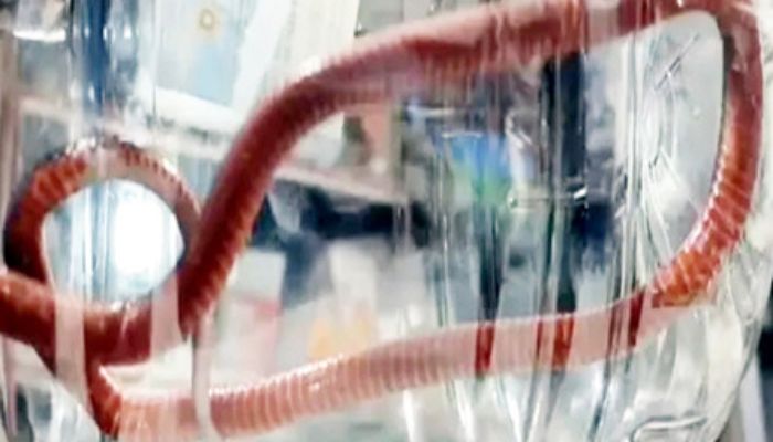 Chikkamagaluruನ Kalasaದ ಕಲ್ಮಕ್ಕಿ ಗ್ರಾಮದಲ್ಲಿ ಅಪರೂಪದ Rakta Kannadi snake ...