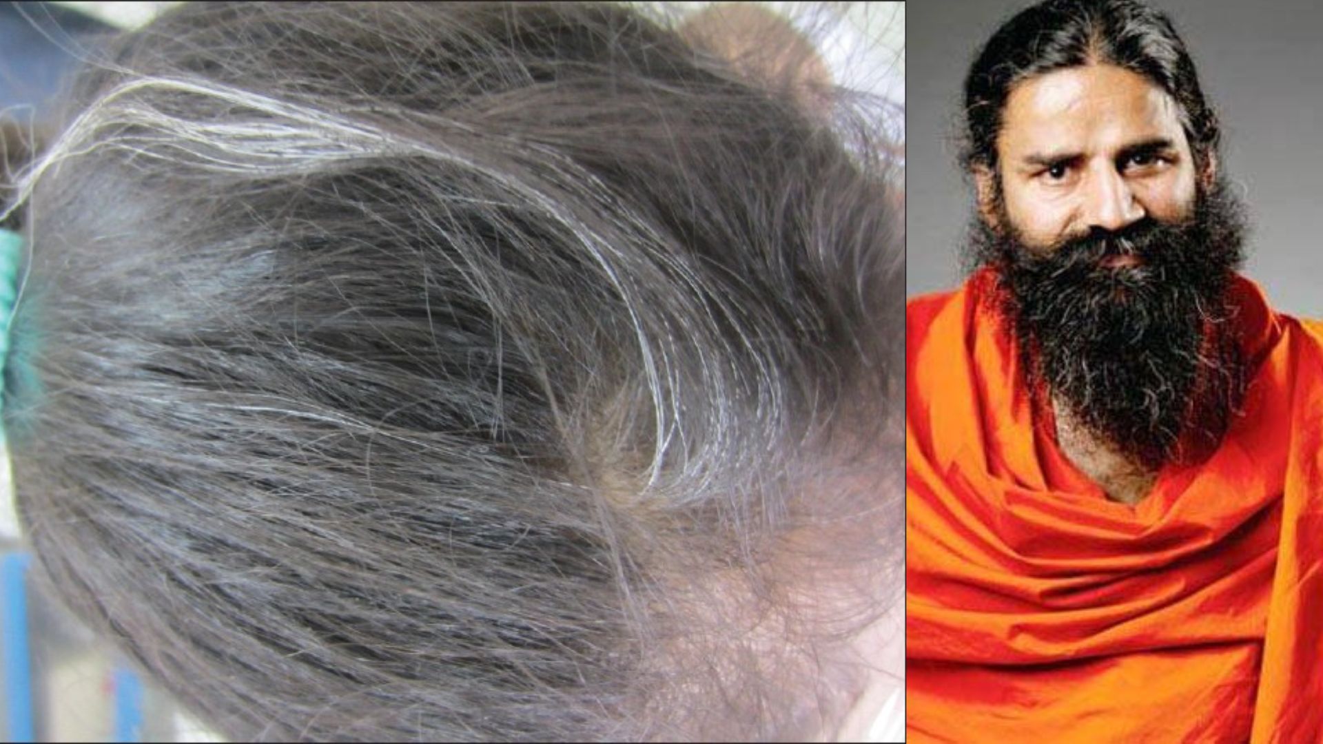 Swami Ramdev's White Hair Remedy: Natural Treatments and Tips | ಈ ...