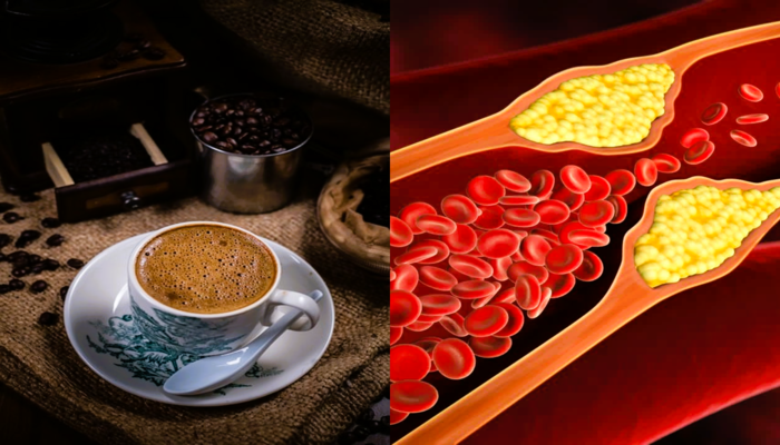 WHAT! Does drinking coffee increase your cholesterol levels? The Truth ...