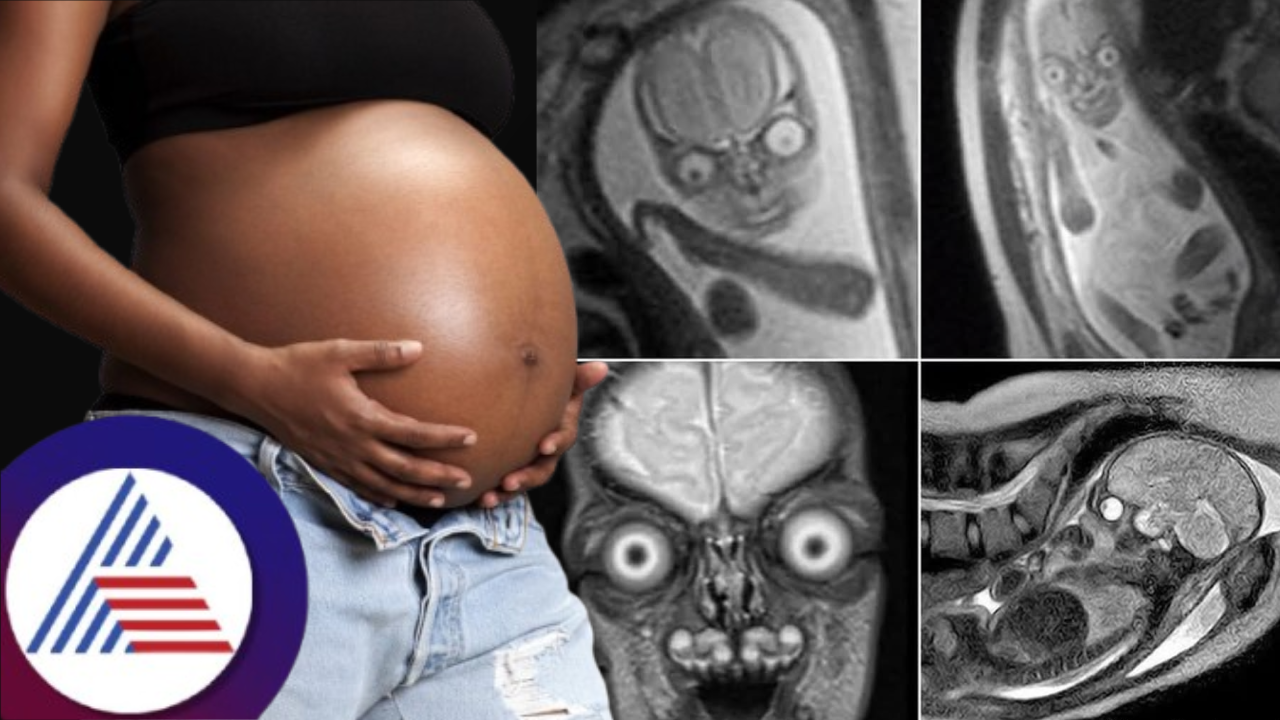 Out of this World! Pregnant Women's MRI Scans Reveal Alien-Like Babies ...