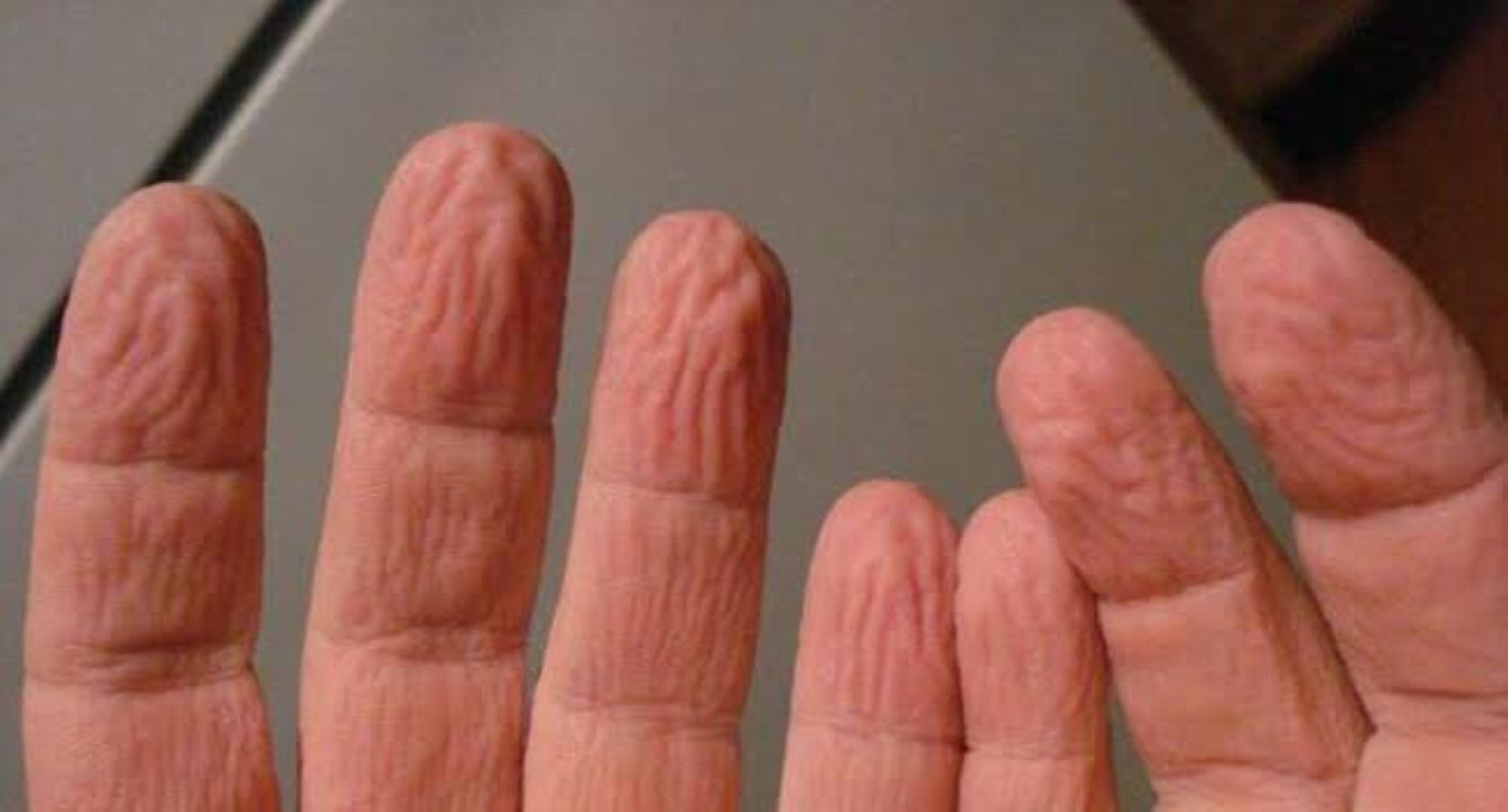 नहाने के बाद उंगलियों पर झुर्रियां क्यों पड़ती हैं? जानिए इसके पीछे की ...