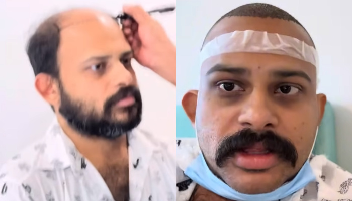 Vijay Madhav: മൊട്ടത്തലയാ, കഷണ്ടി, തുടങ്ങിയ വിളികൾക്ക് അവസാനം ...